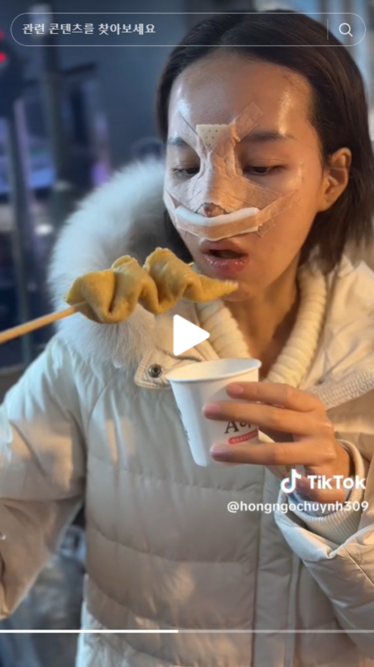 더쿠 1600만원 들여 한국서 성형수술… 인생이 완전히 바뀐 베트남 여성 인플루언서